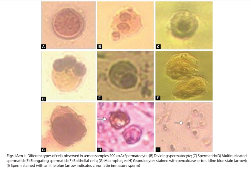 Significance of Evaluating Immature Germ Cells during Semen Analysis
